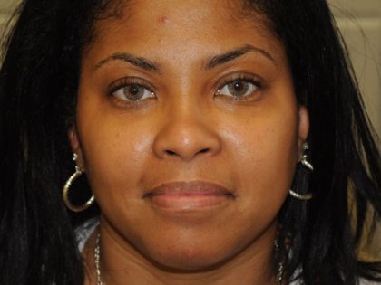 Patient #494 Dimple Creation Before and After Photos New Bern, NC ...