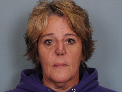 Patient #3690 Reconstruction Before and After Photos New Bern, NC ...