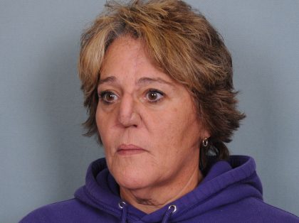 Patient #3690 Reconstruction Before and After Photos New Bern, NC ...